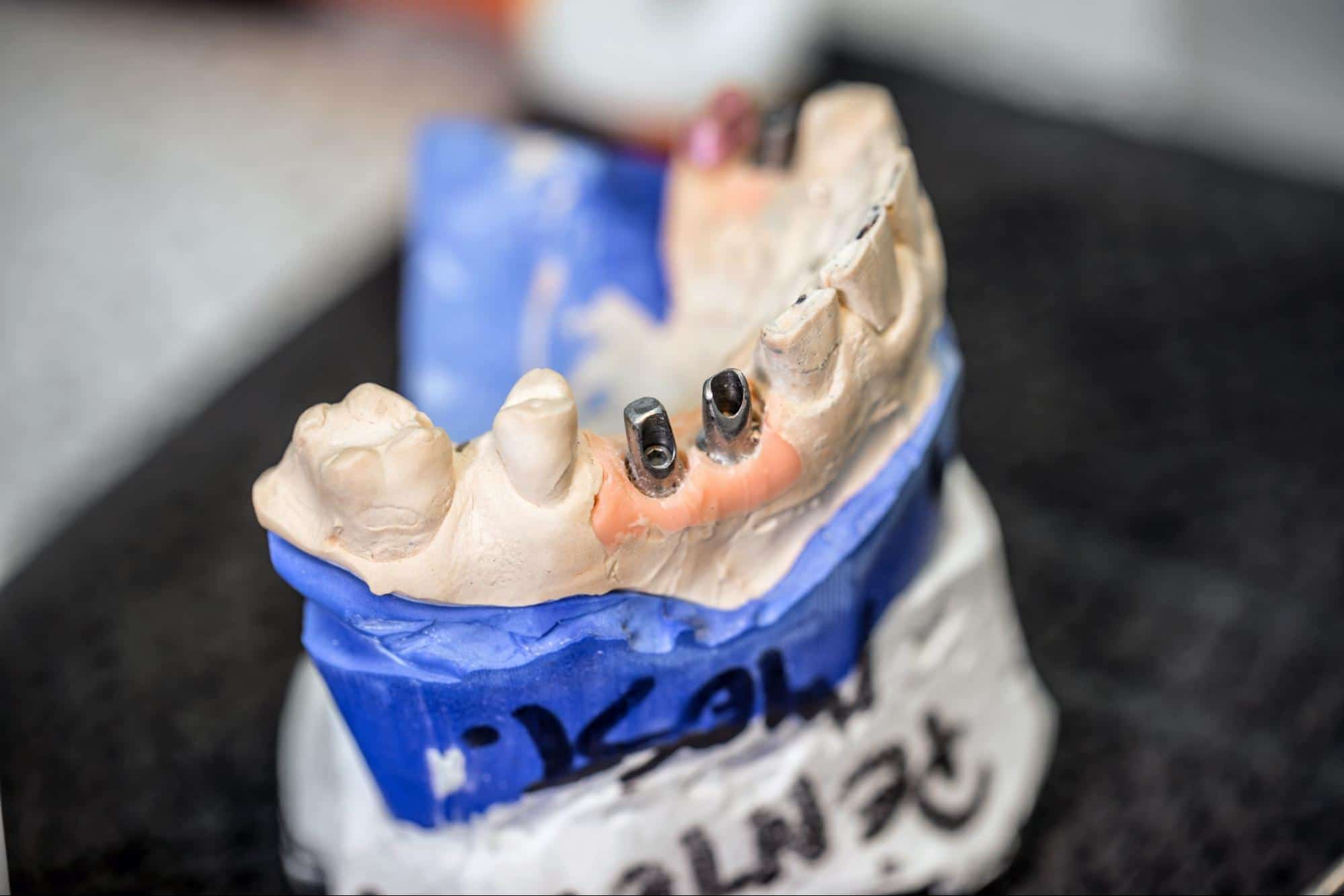 What Is A Dental Implant Healing Cap Somos Camelback